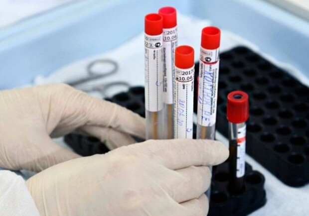 Коронавирус в Одессе и Одесской области: статистика на 17 мая 2021 года - Одесса Vgorode.ua