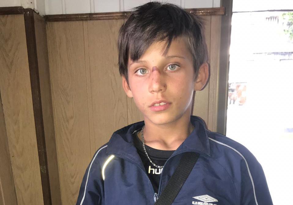 В Днепре пропал 12-летний Николай Федотов - Днепр Vgorode.ua